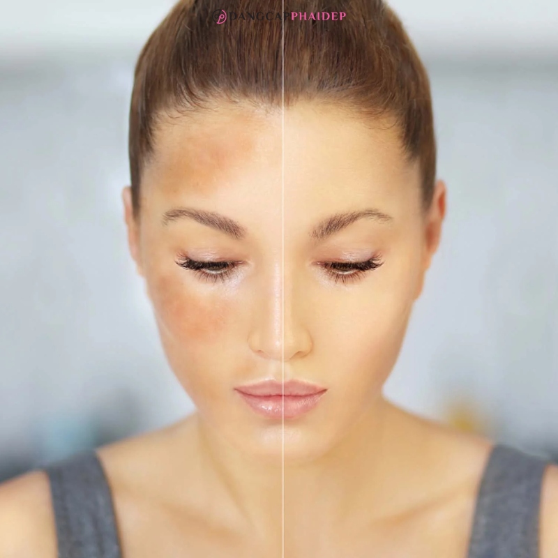 Xcelens Fragmyx Oxyx làm sáng, tái tạo da và ngăn lão hóa